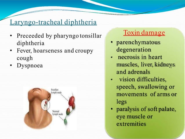 Diptheria Final.pptx