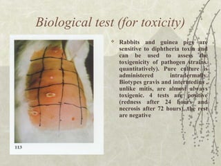 DIPTHERIA IN CHILDREN caused by bacteria | PPTX
