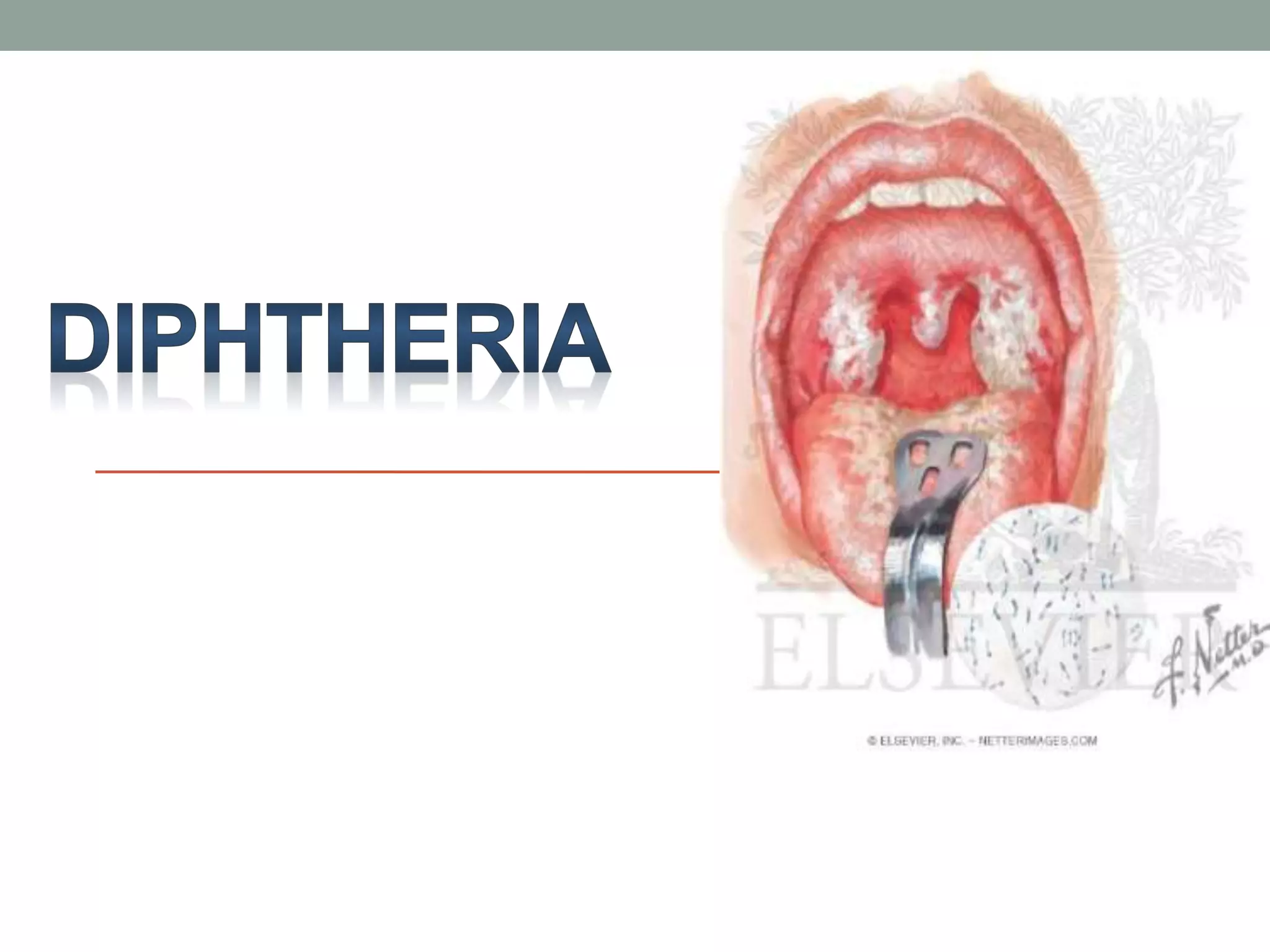 Diptheria (For Undergraduates) | PPTX