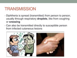 Diptheria (For Undergraduates) | PPT