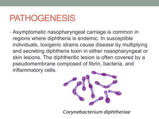 Diptheria (For Undergraduates) | PPT