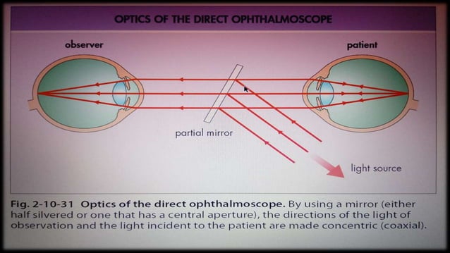 Direct ophthalmoscopy | PPTX | Eye and Vision Conditions | Diseases and ...