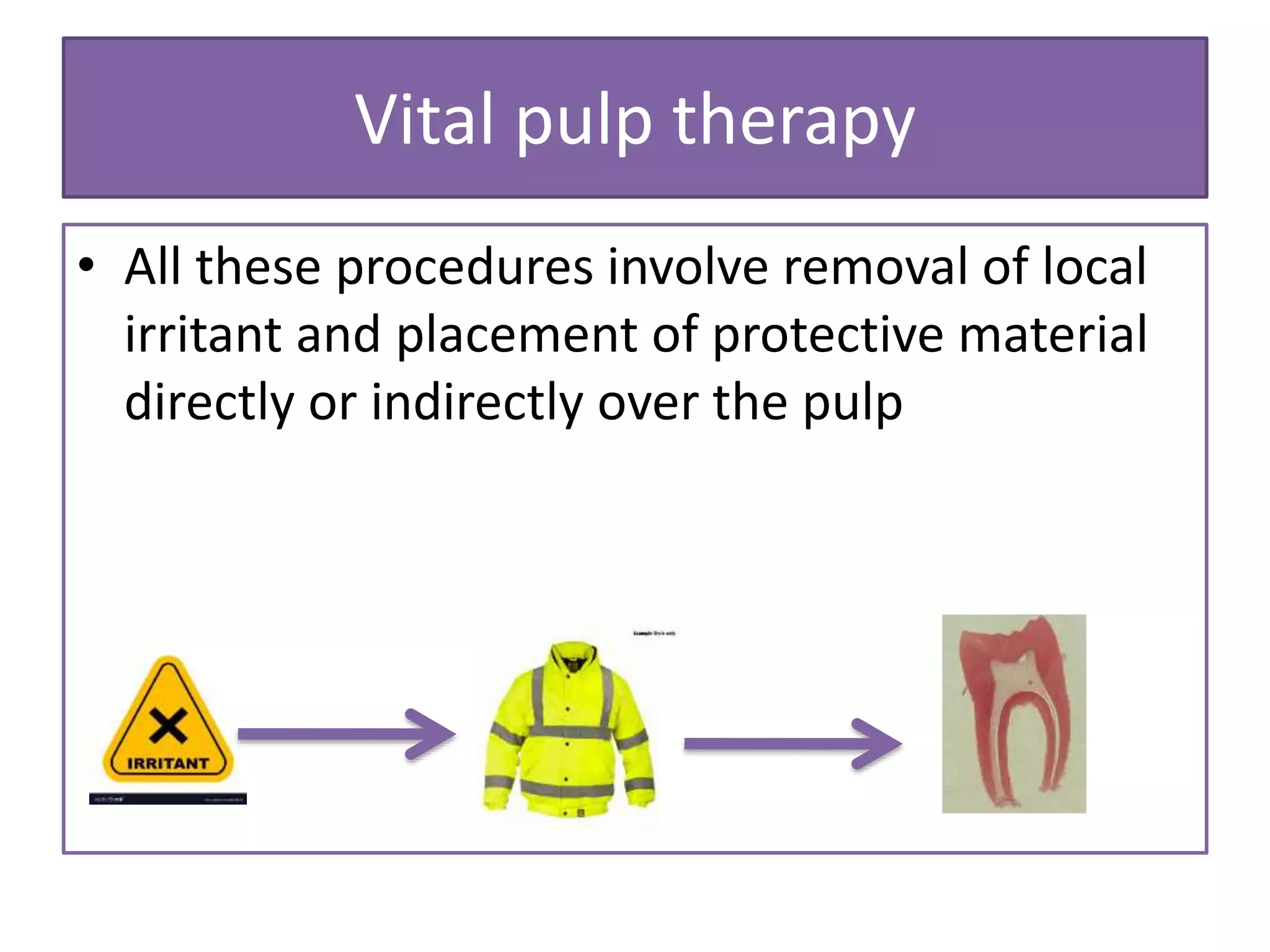 Direct and indirect pulp capping | PPTX