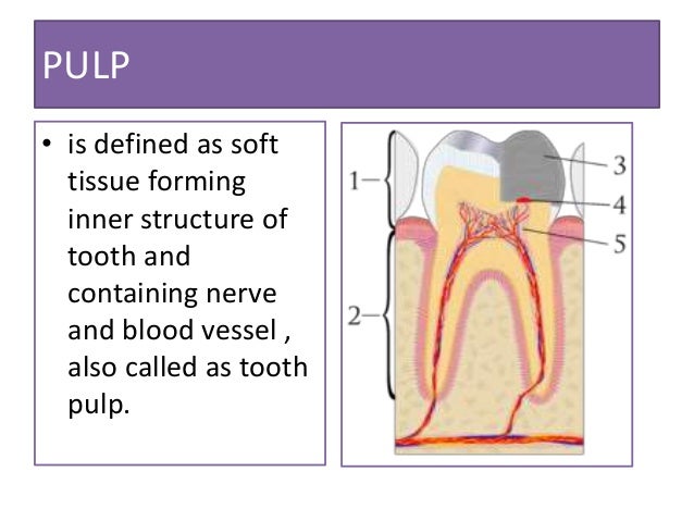 Direct and indirect pulp capping