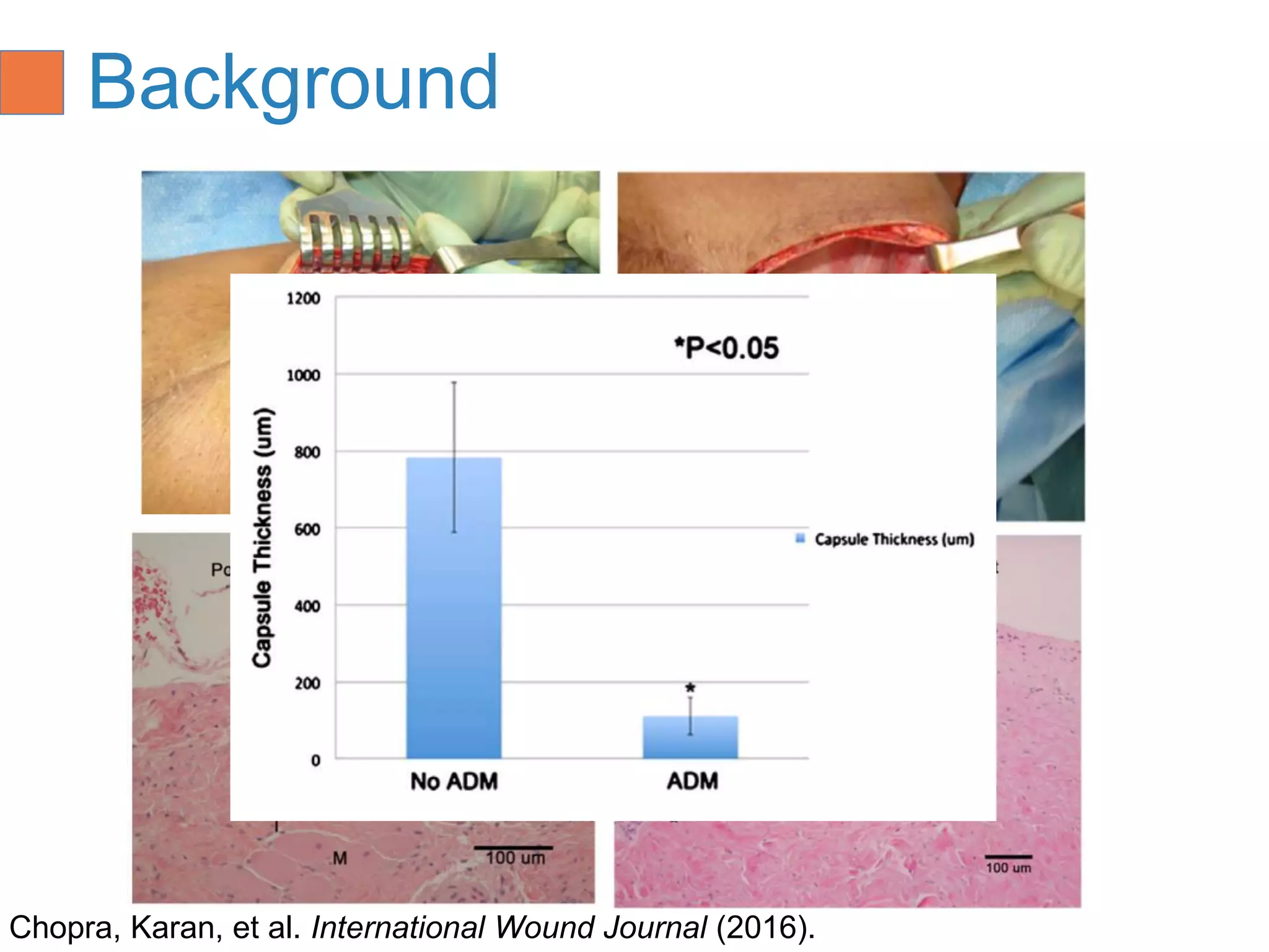 Direct to Implant Prepectoral Breast Reconstruction | PPTX