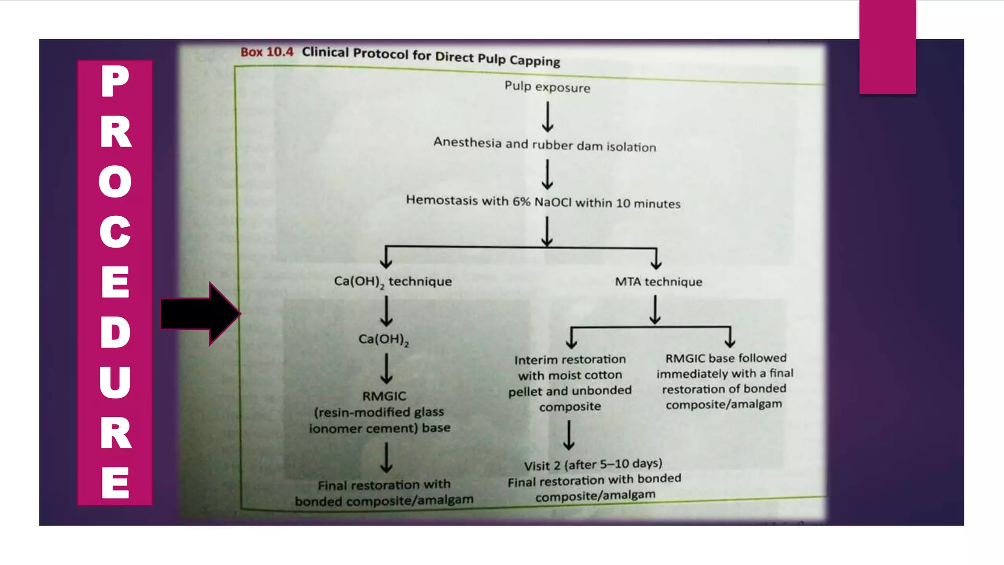 Direct and Indirect pulp capping | PPTX