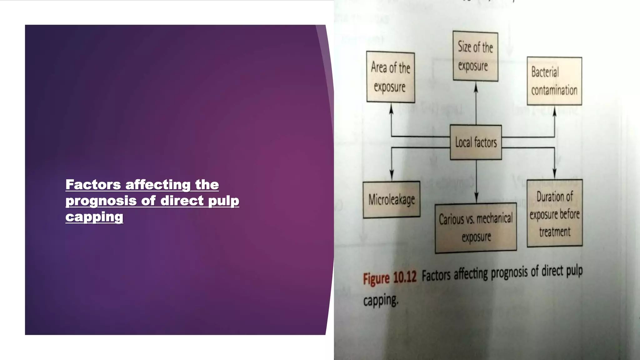 Direct and Indirect pulp capping | PPTX