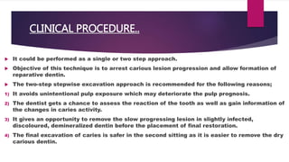 Direct and Indirect pulp capping | PPT