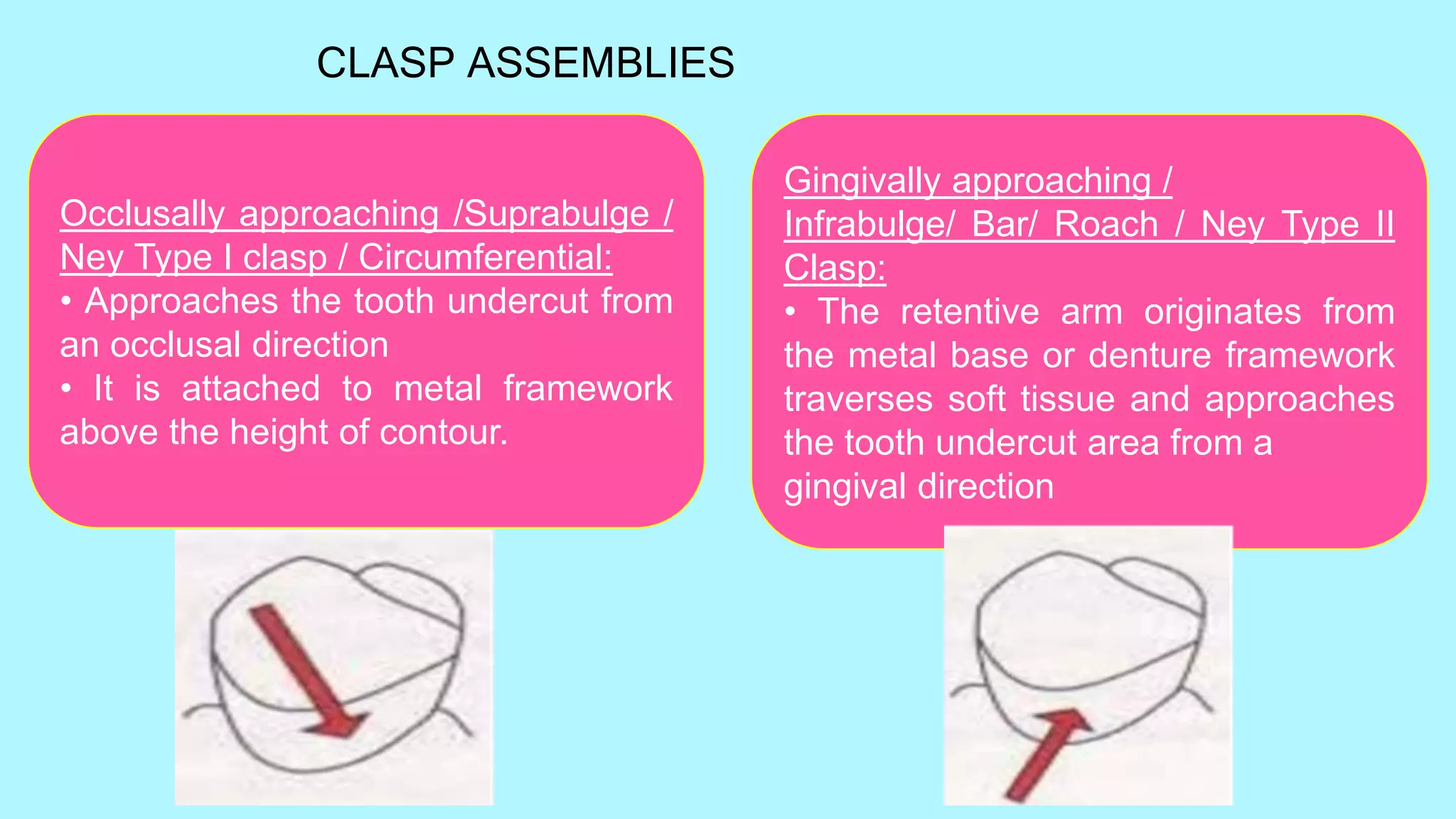 Direct and indirect retainers | PPTX