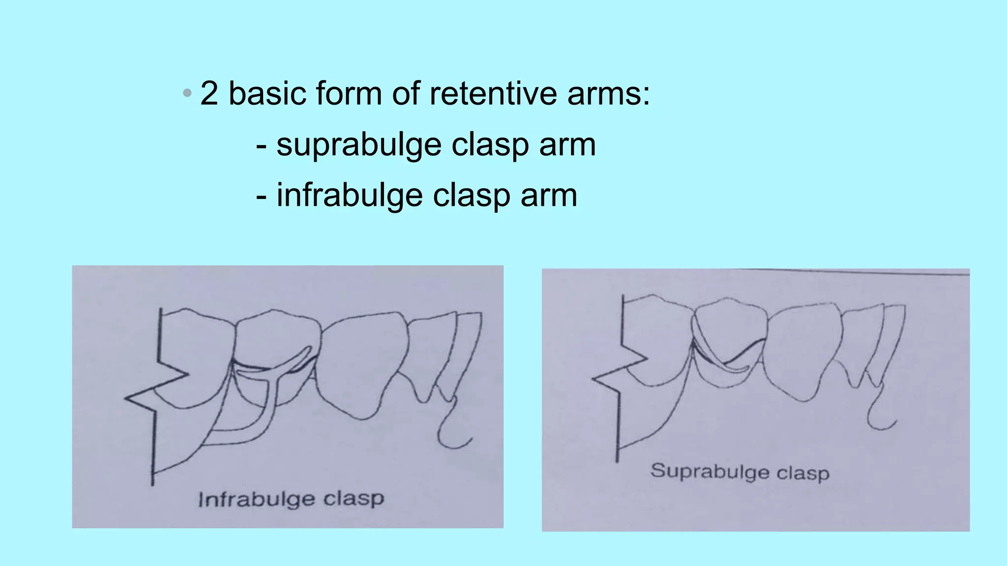 Direct and indirect retainers | PPTX