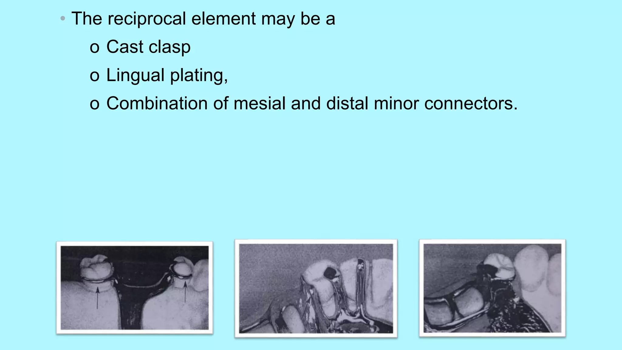 Direct and indirect retainers | PPTX | Oral care | Personal Care