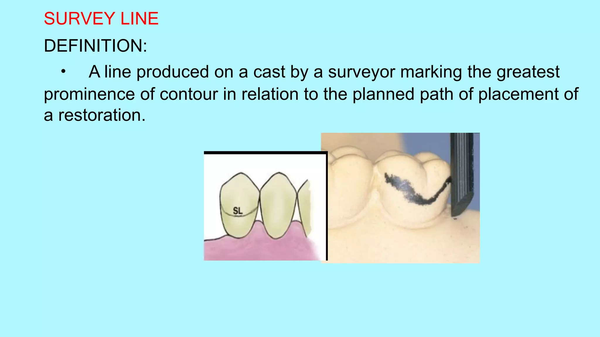 Direct and indirect retainers | PPTX