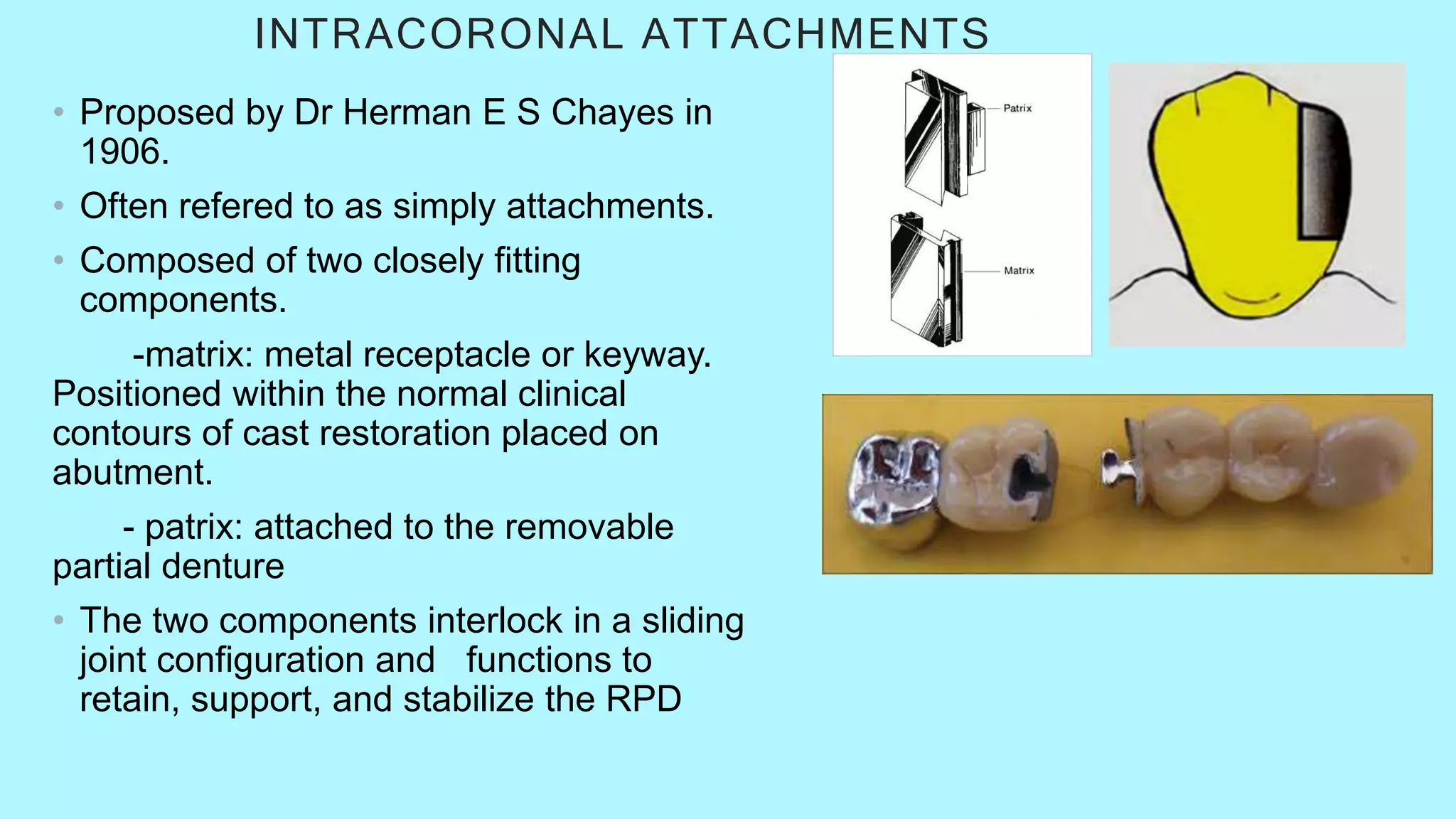 Direct and indirect retainers | PPTX