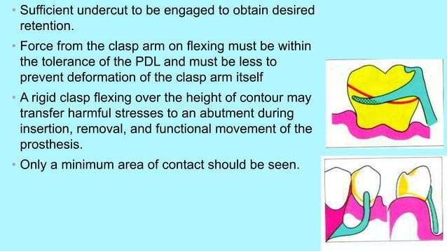 Direct and indirect retainers | PPTX | Oral care | Personal Care