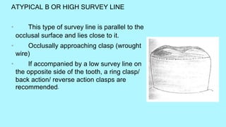 Direct and indirect retainers | PPTX