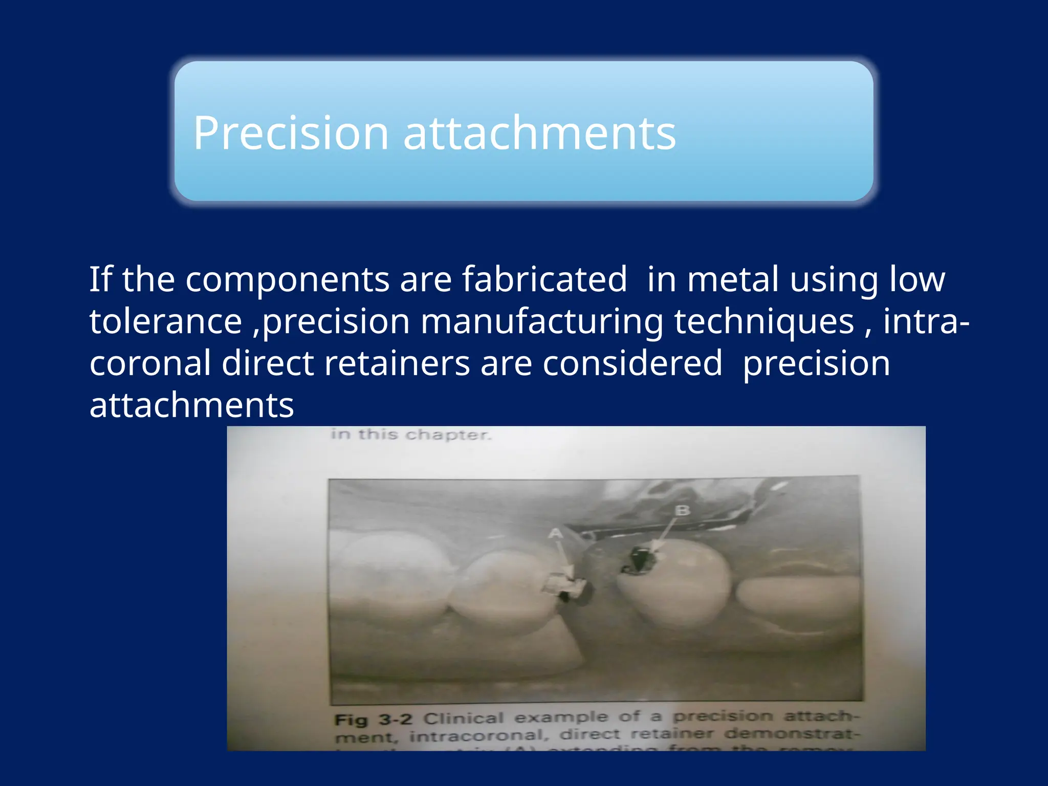 DIRECT AND INDIRECT RETAINERS in prosthodontics | PPTX