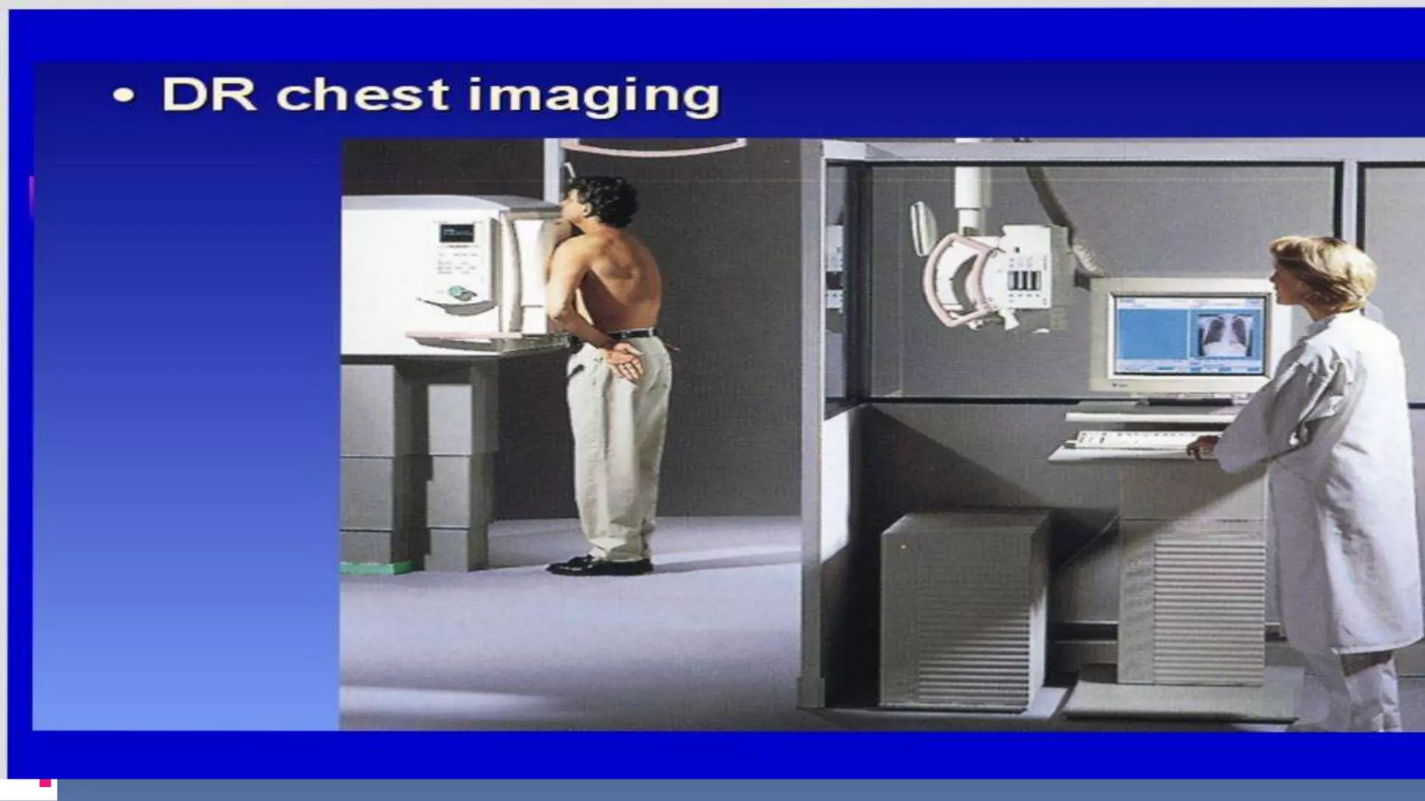 Direct digital radiography(1) (1) | PPTX