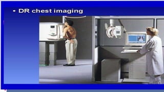 Direct digital radiography(1) (1) | PPTX