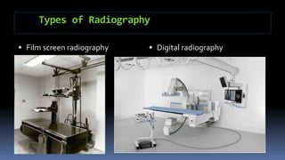Direct digital radiography(1) (1) | PPTX