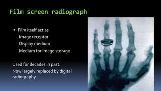Direct digital radiography(1) (1) | PPTX