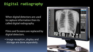 Direct digital radiography(1) (1) | PPTX