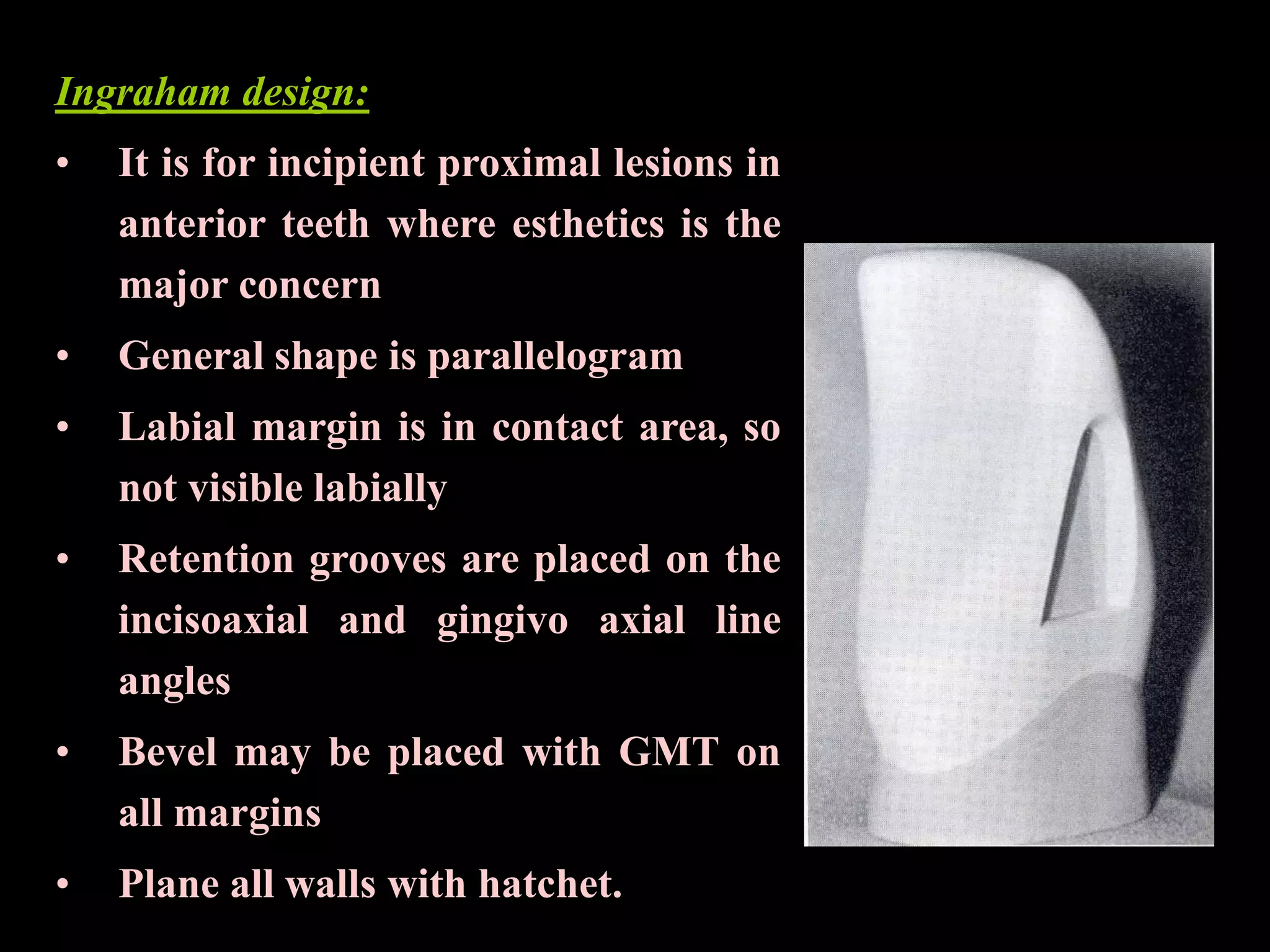 Direct filling gold | PPT