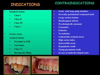 Direct filling gold | PPT