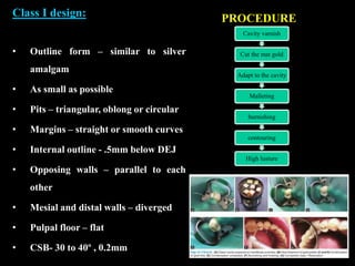 Direct filling gold | PPT