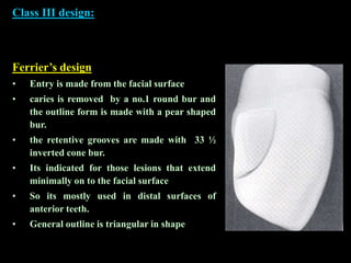 Direct filling gold | PPT