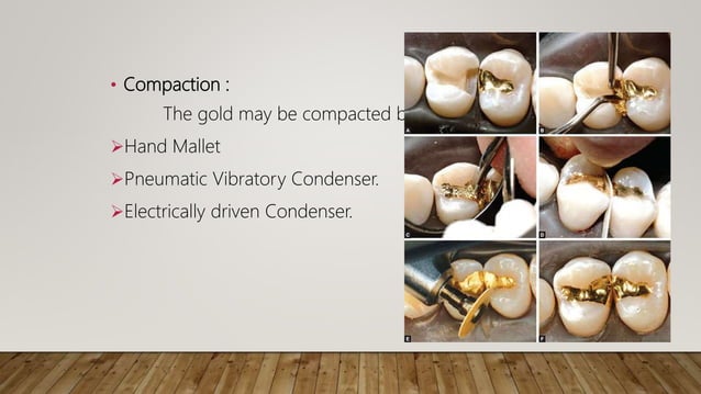 Direct filling gold | PPTX | Chemistry | Science