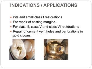 DIRECT FILLING GOLD_014824.pptx