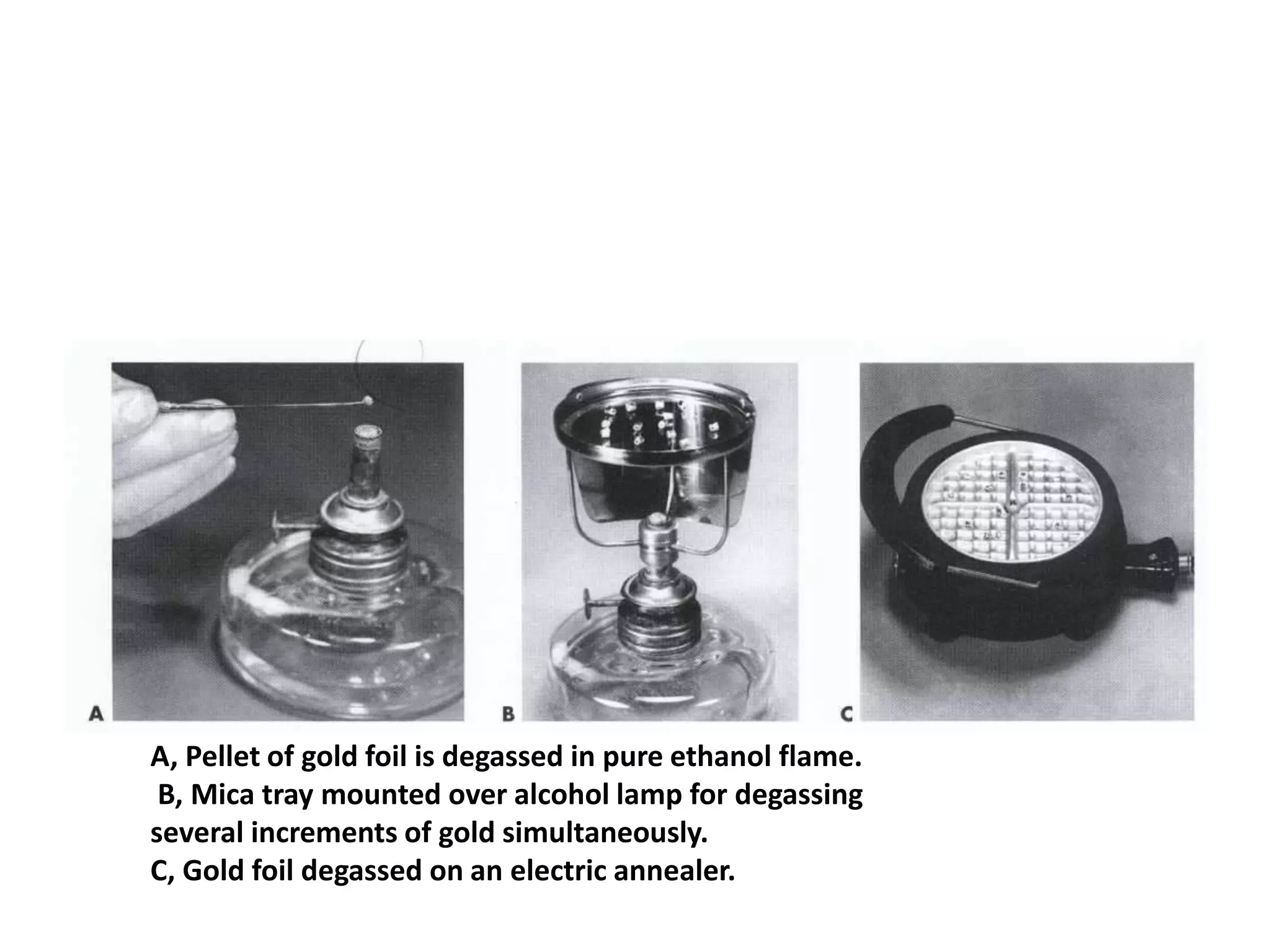 Direct gold restoration | PPTX