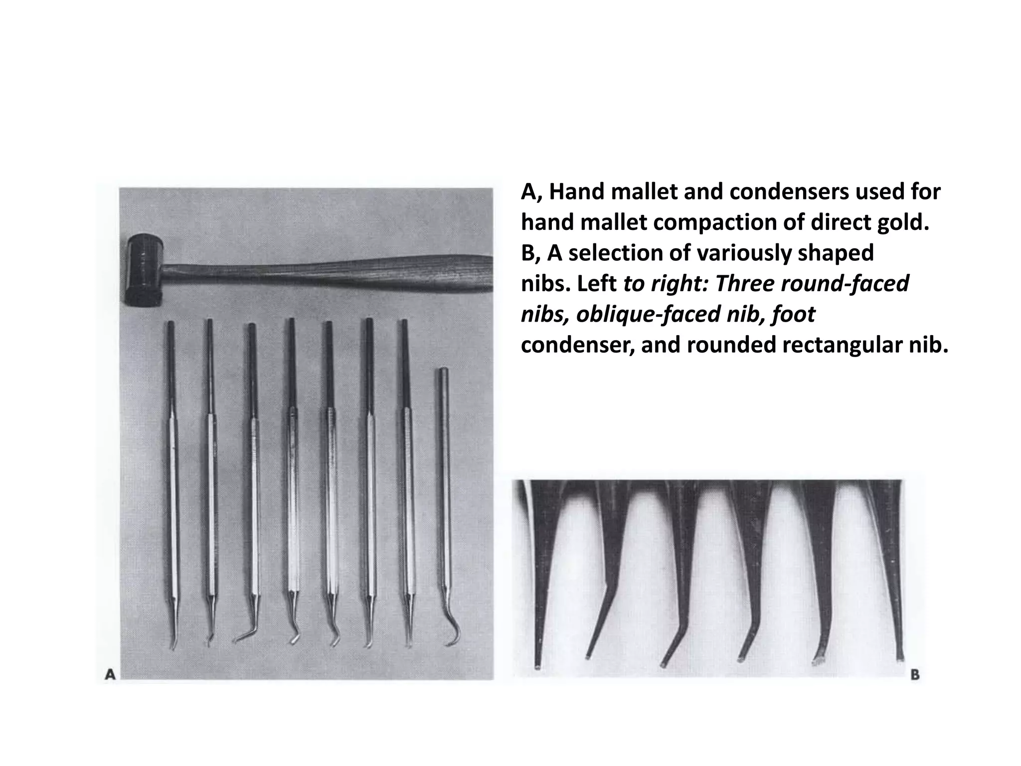 Direct gold restoration | PPTX