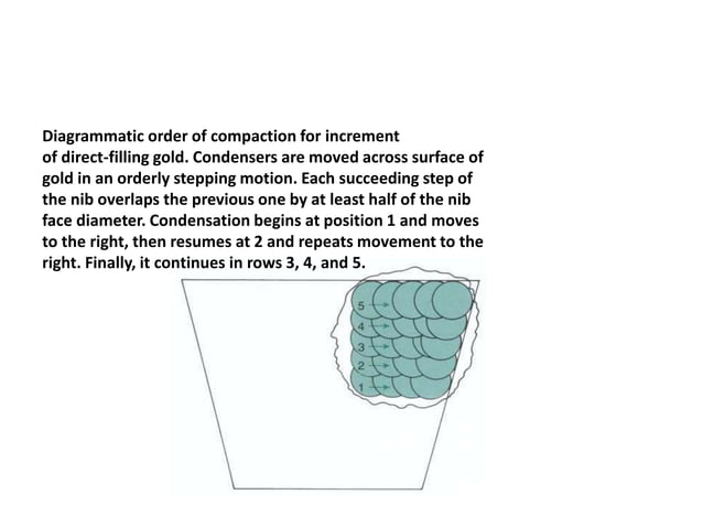 Direct gold restoration | PPTX | Dental Health | Diseases and Conditions