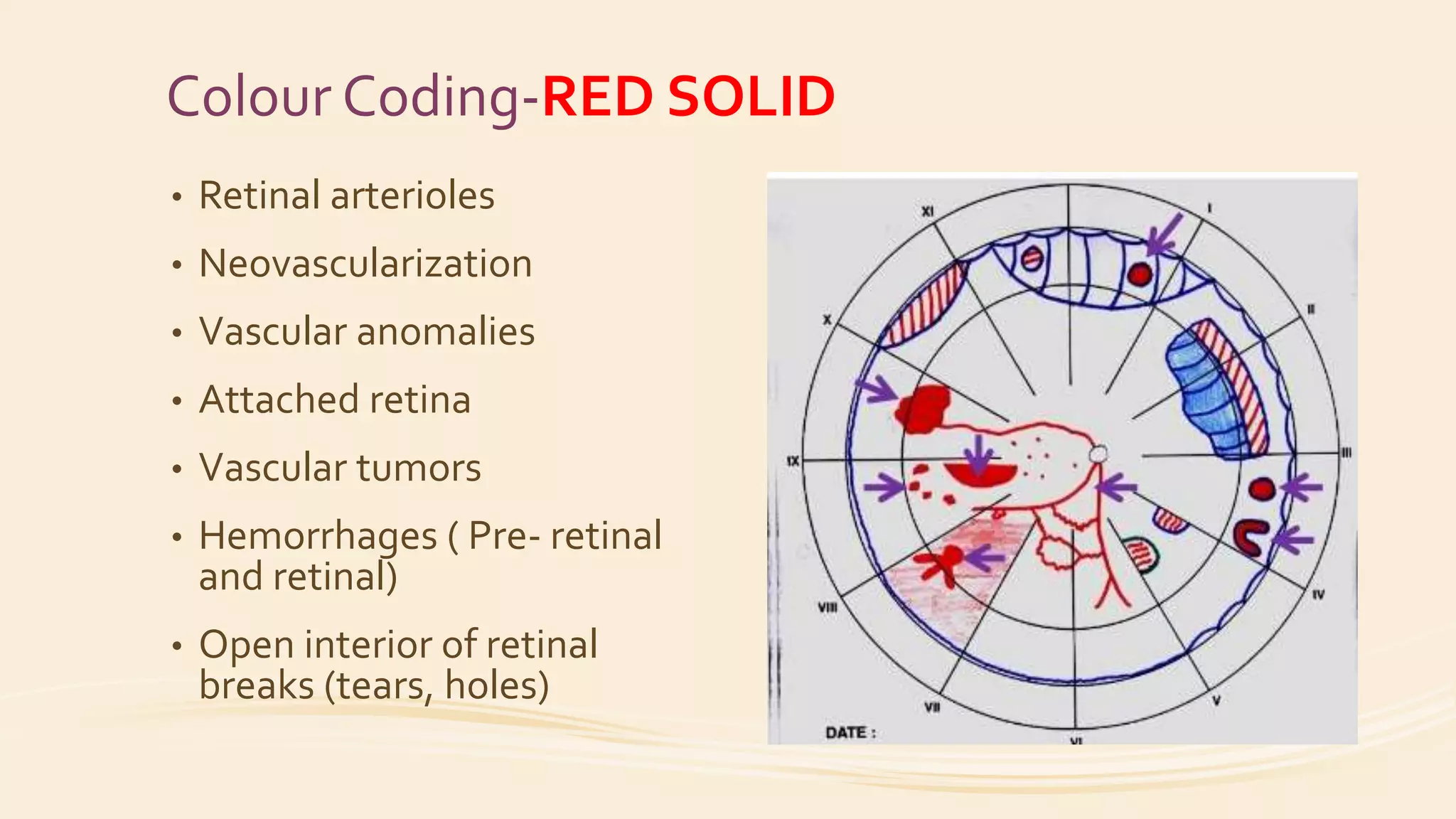Direct & indirect ophthalmoscopy | PPTX