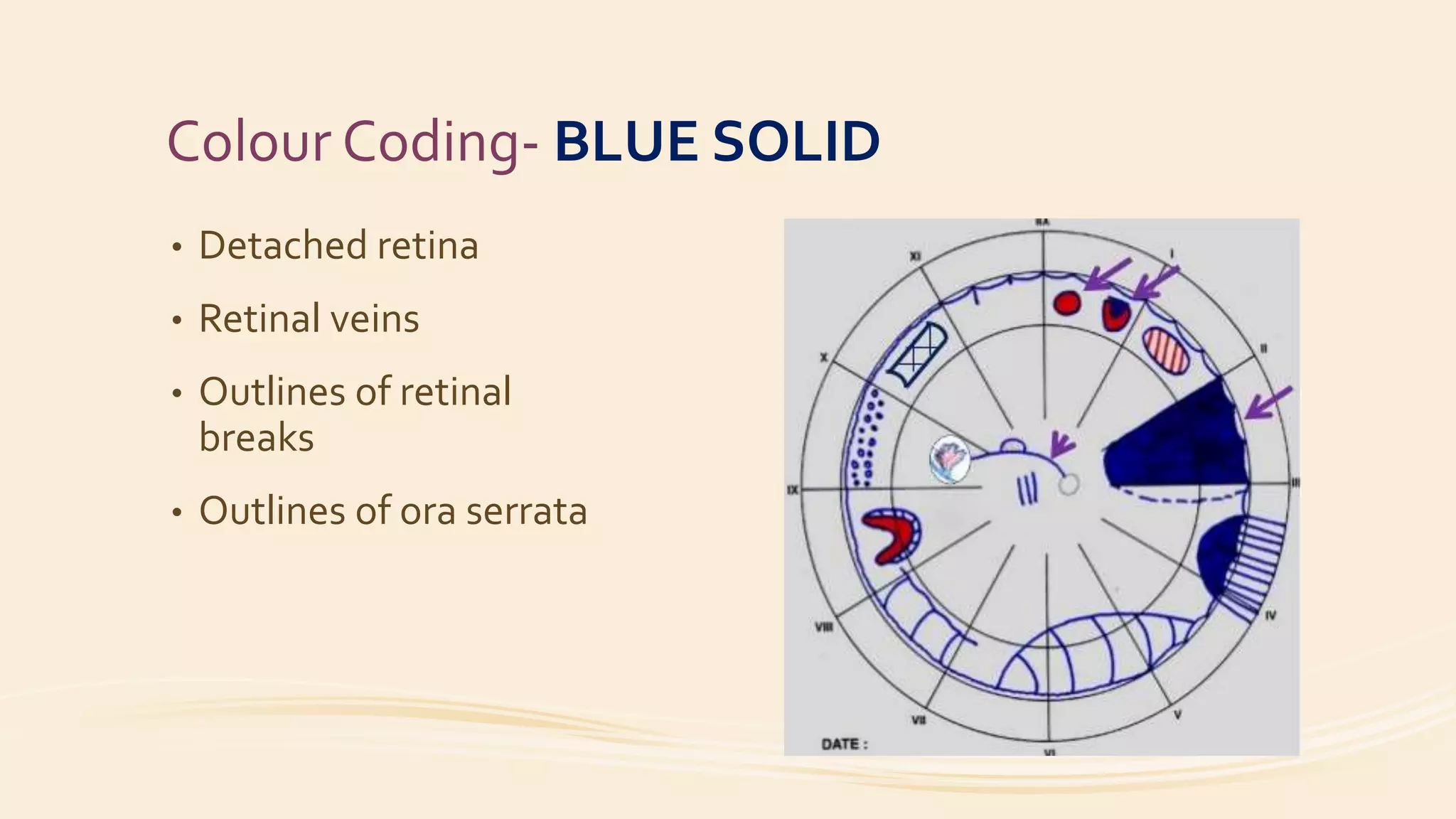 Direct & indirect ophthalmoscopy | PPTX