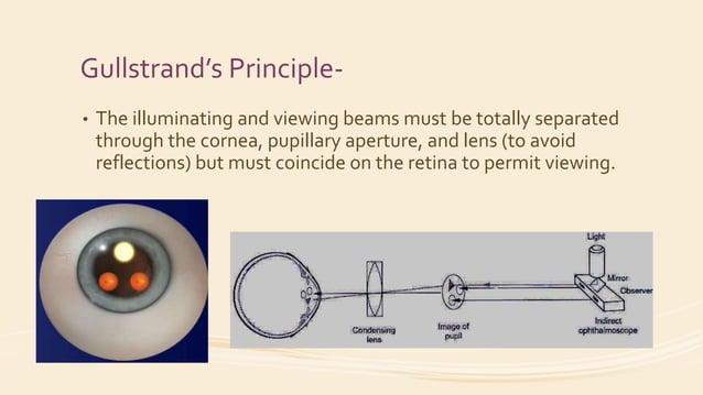 Direct & indirect ophthalmoscopy | PPTX | Eye and Vision Conditions ...