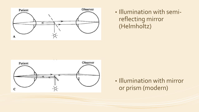 Direct & indirect ophthalmoscopy | PPTX | Eye and Vision Conditions ...