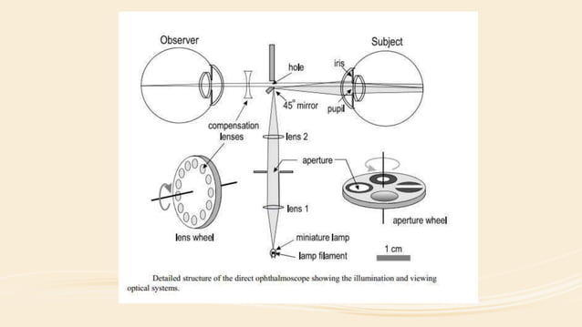 Direct & indirect ophthalmoscopy | PPTX | Eye and Vision Conditions ...