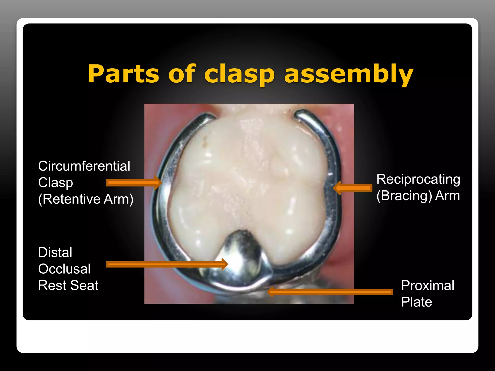 Direct & indirect retainers in rpd | PPTX