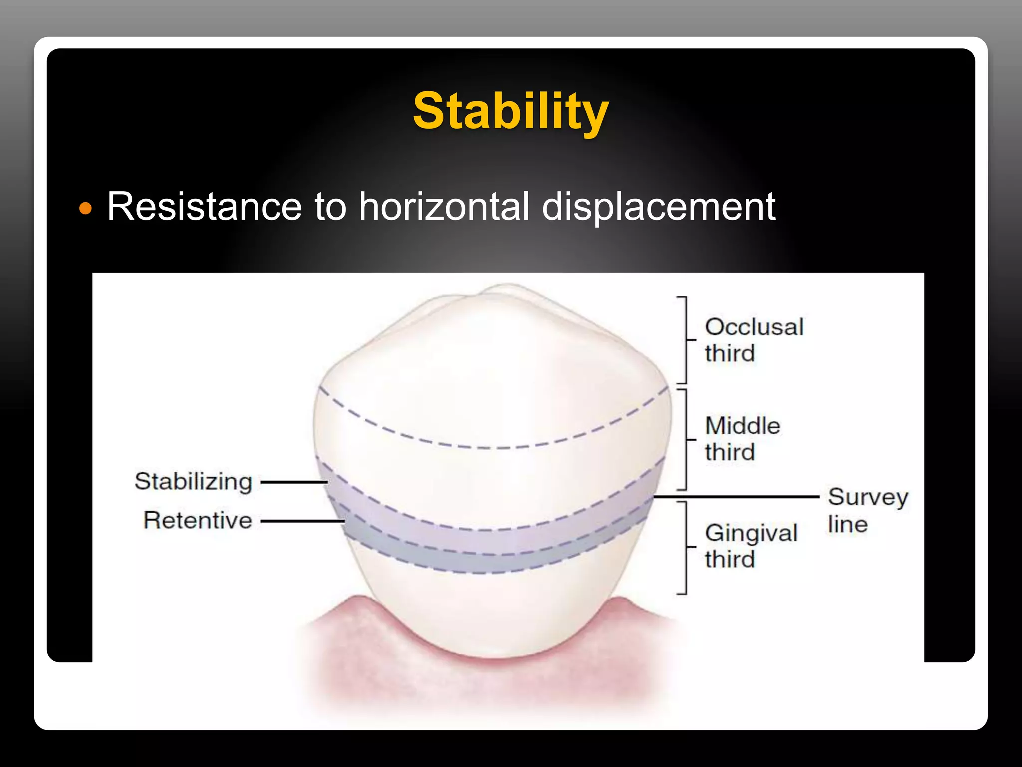 Direct & indirect retainers in rpd | PPTX