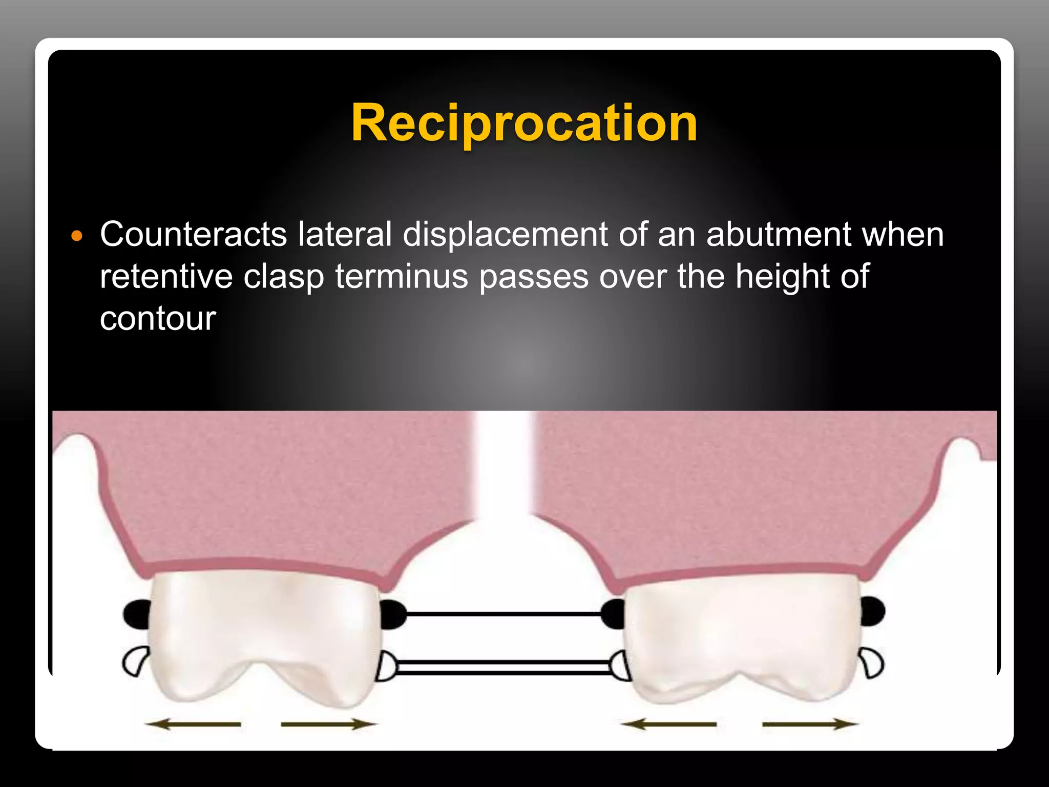 Direct & indirect retainers in rpd | PPTX