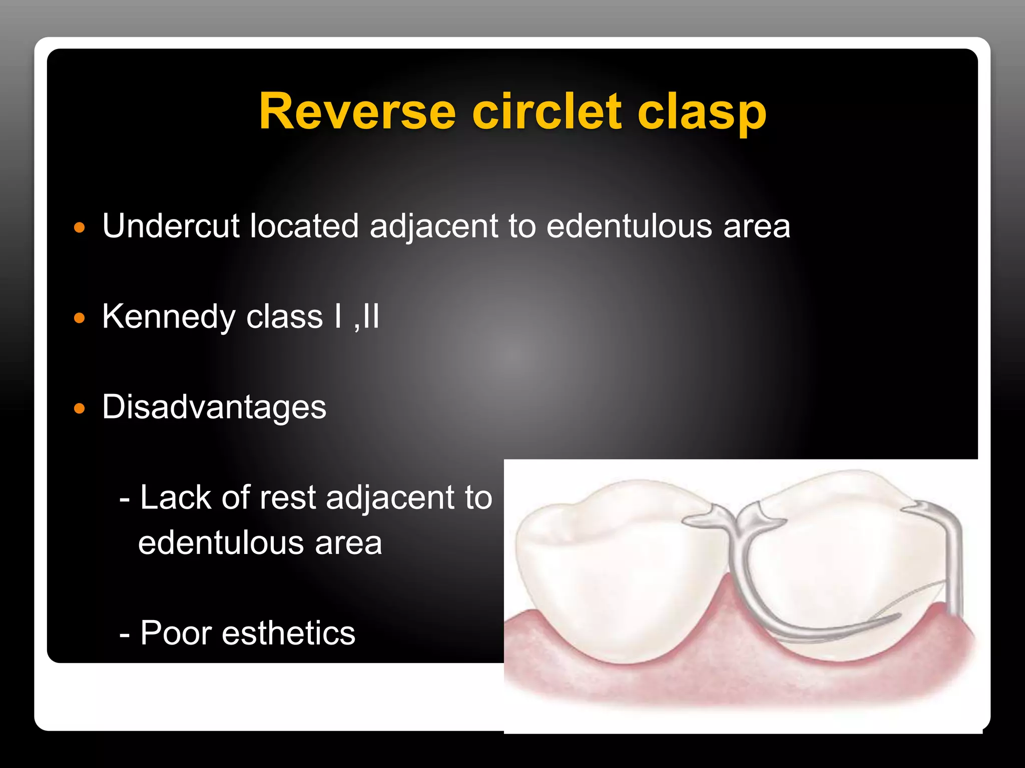 Direct & indirect retainers in rpd | PPTX
