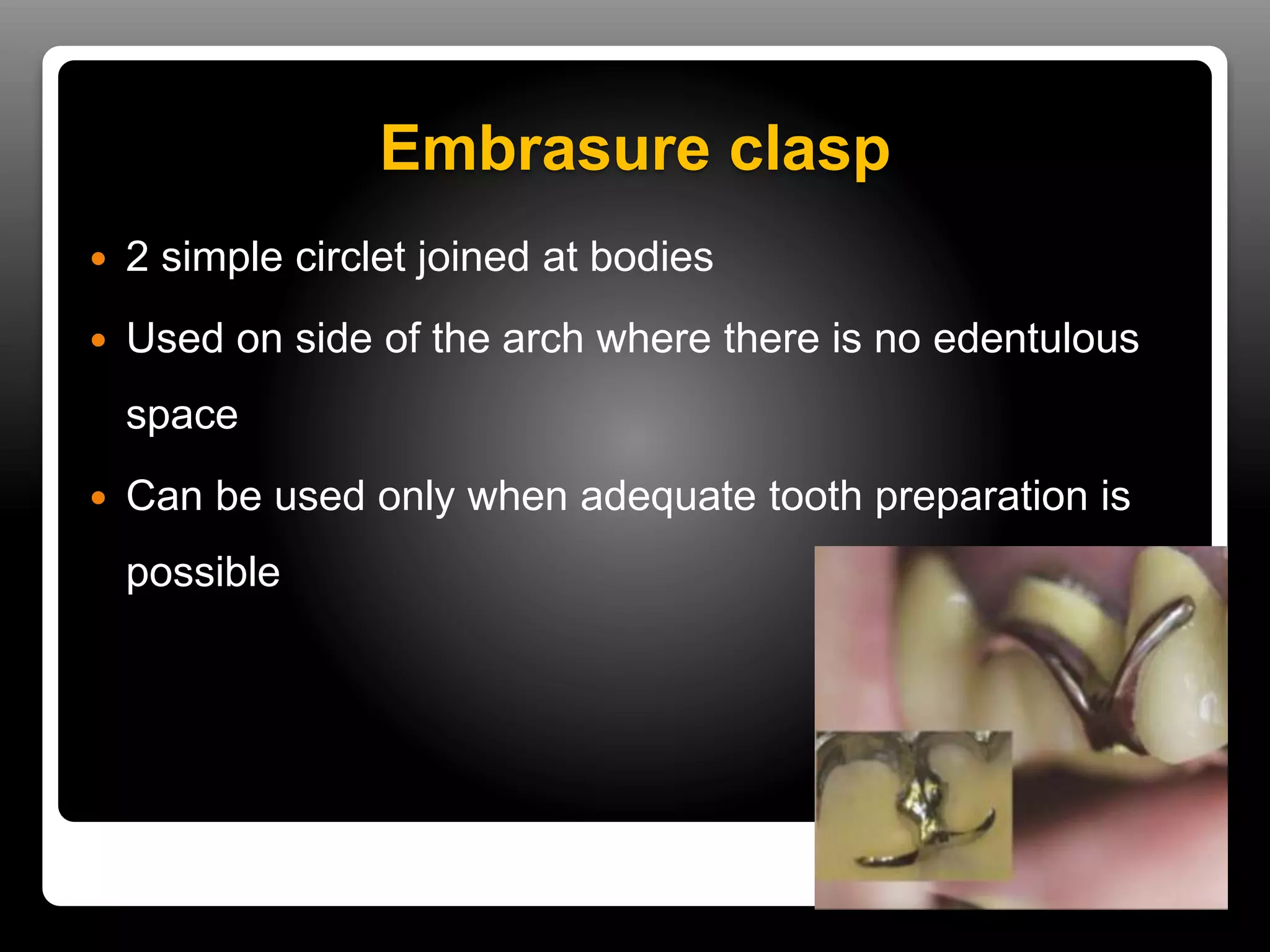 Direct & indirect retainers in rpd | PPTX