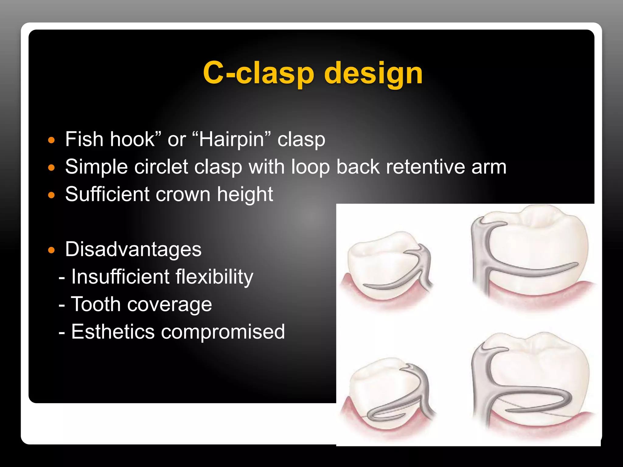 Direct & indirect retainers in rpd | PPTX