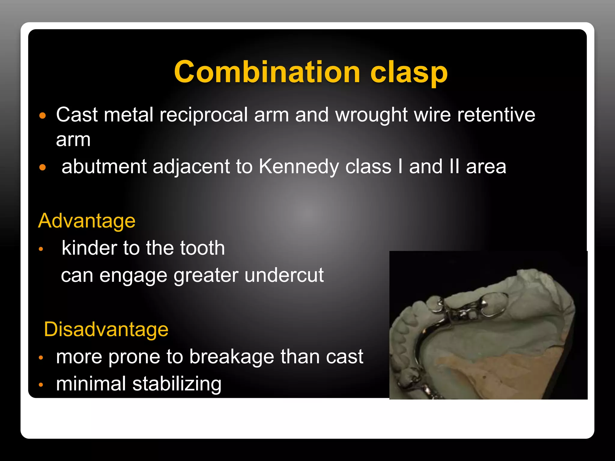 Direct & indirect retainers in rpd | PPTX