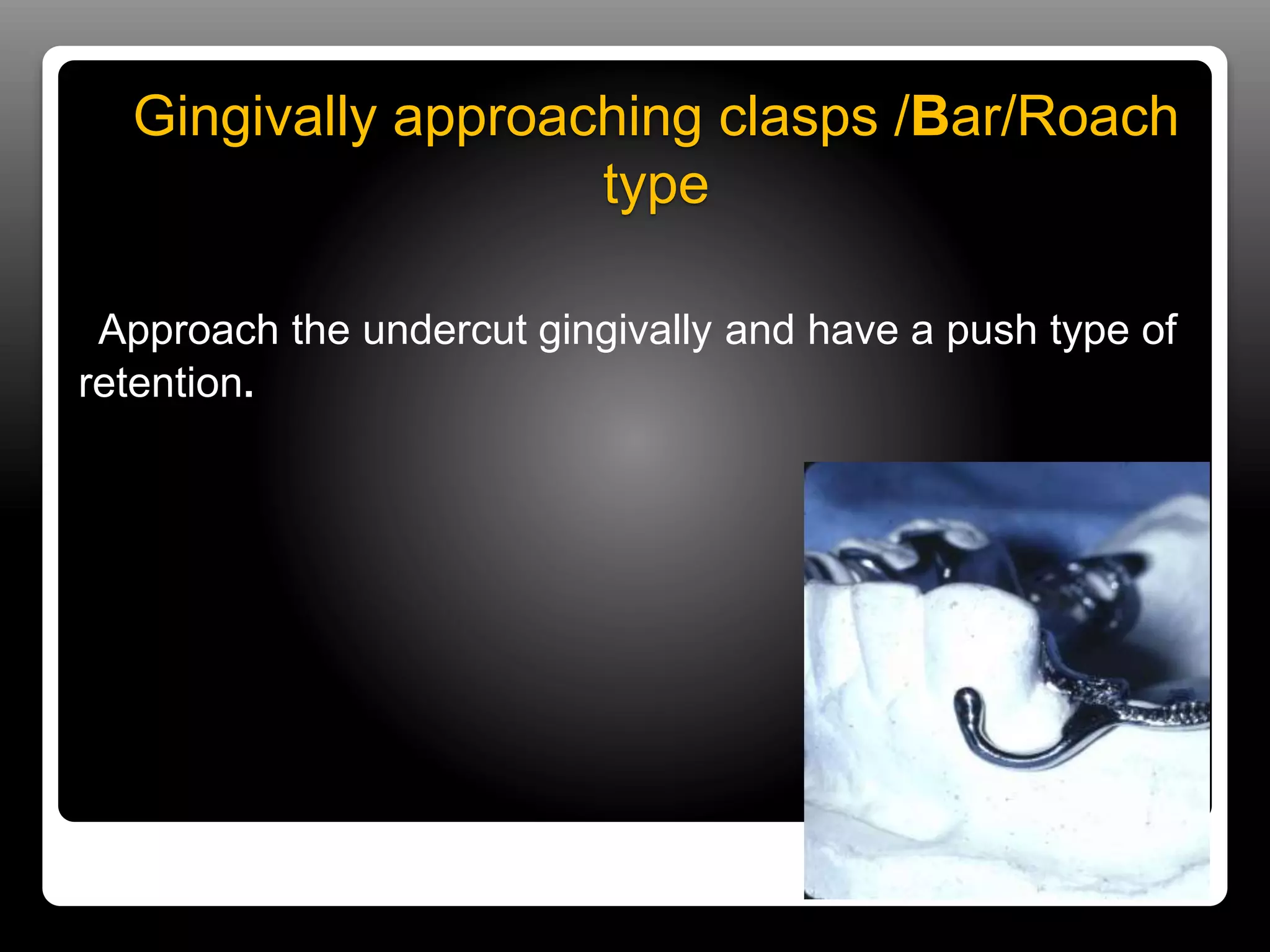 Direct & indirect retainers in rpd | PPTX