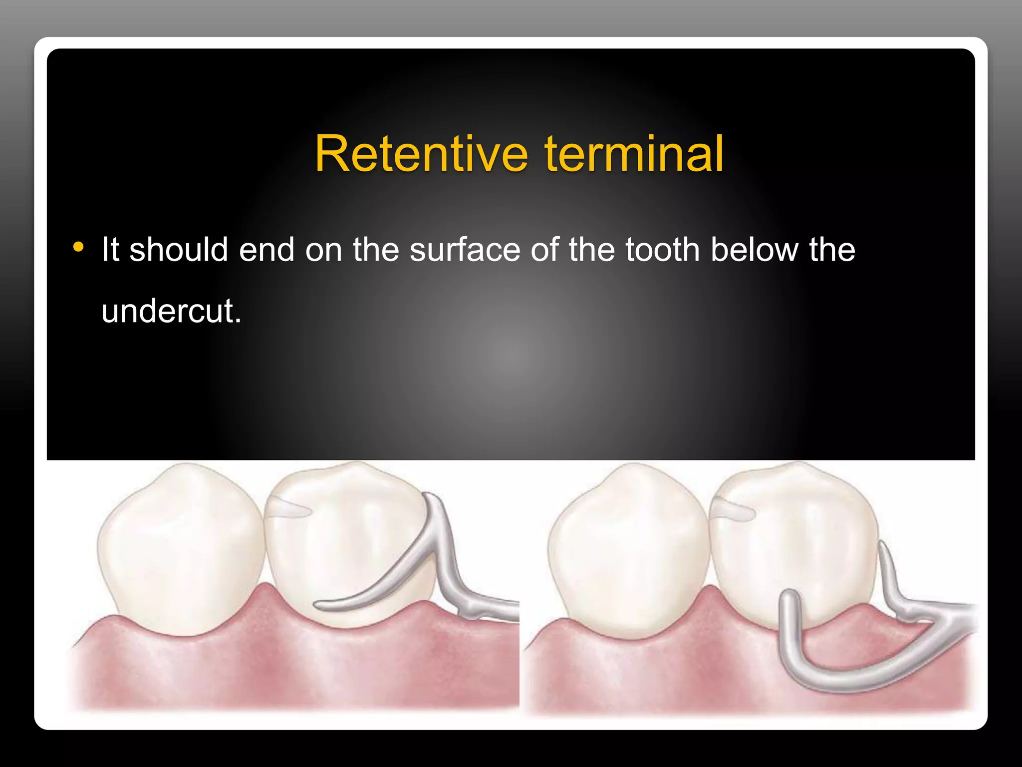 Direct & indirect retainers in rpd | PPTX