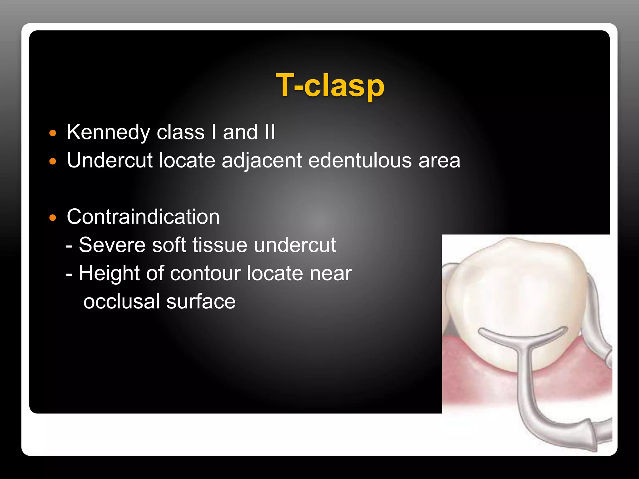 Direct & indirect retainers in rpd | PPTX