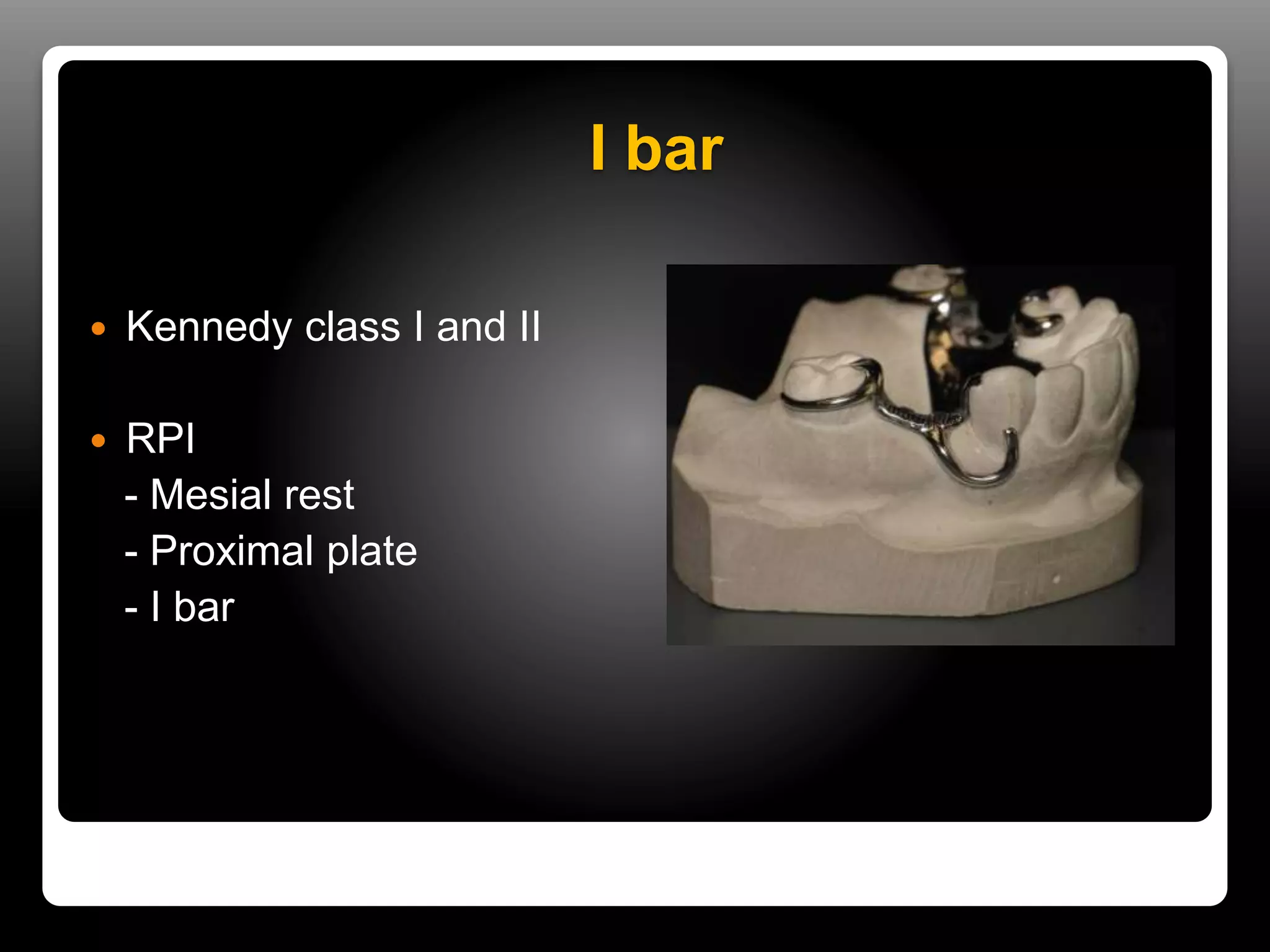 Direct & indirect retainers in rpd | PPTX